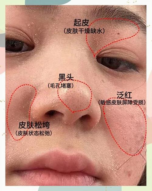 皮肤干燥起皮的原因图标
