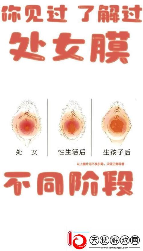女生破膜平均多少岁图标