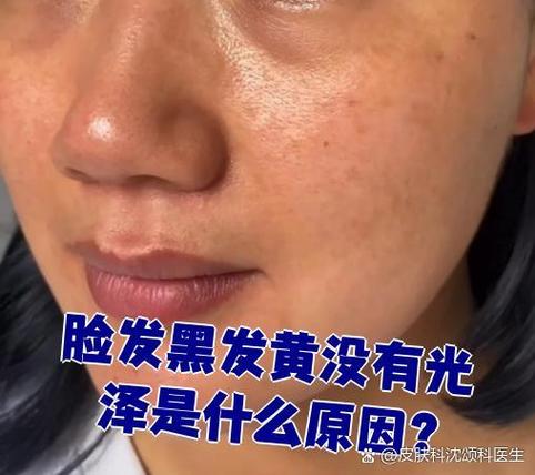 脸黑无光泽是什么原因图标