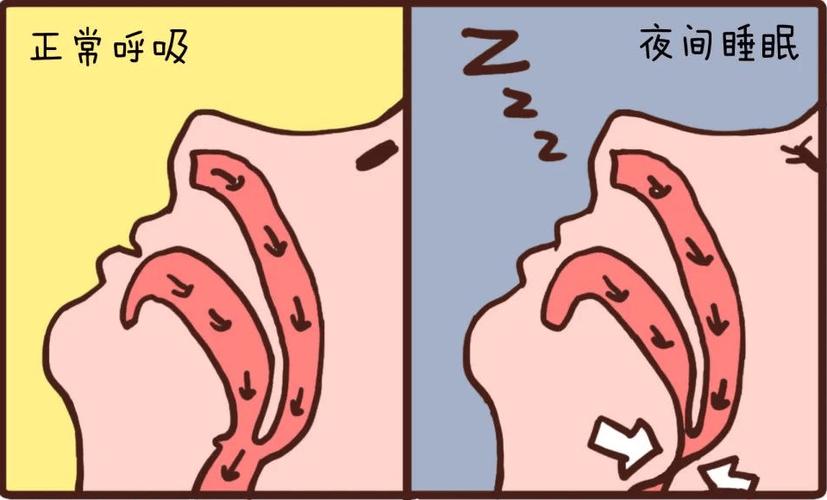 经常晚上睡觉被吵醒的危害图标