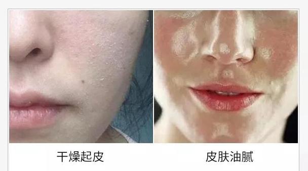 皮肤粗糙如何改善图标