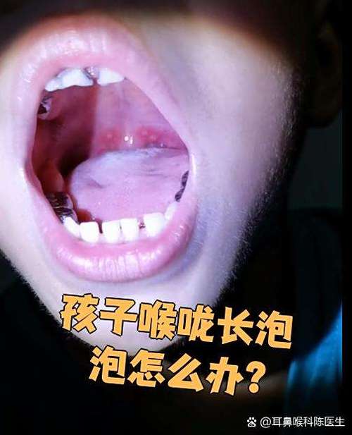 嗓子有小泡泡是病毒吗图标