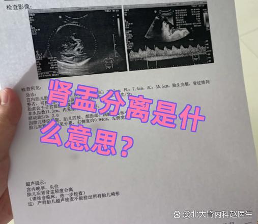 分离暗区是什么图标