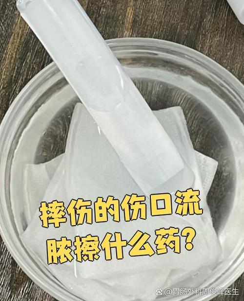 被打了用什么药擦得好截图