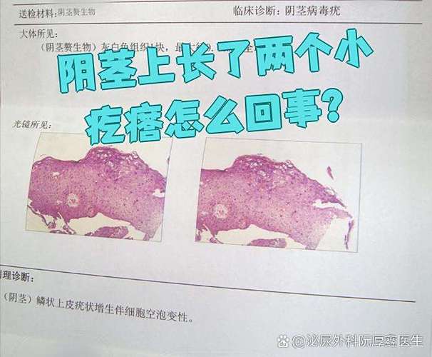 小鸡上长疙瘩了怎么回事图标