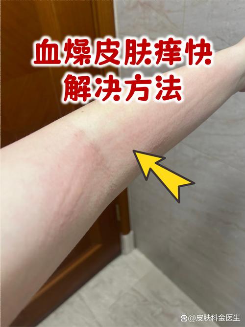 遇仙人跳怎么自救图标