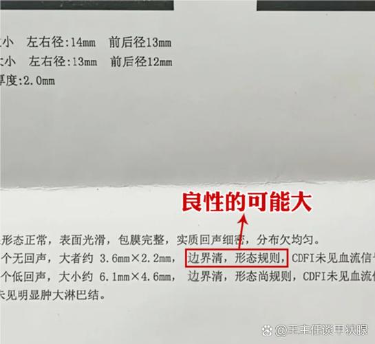 强回声是良性还是恶性图标