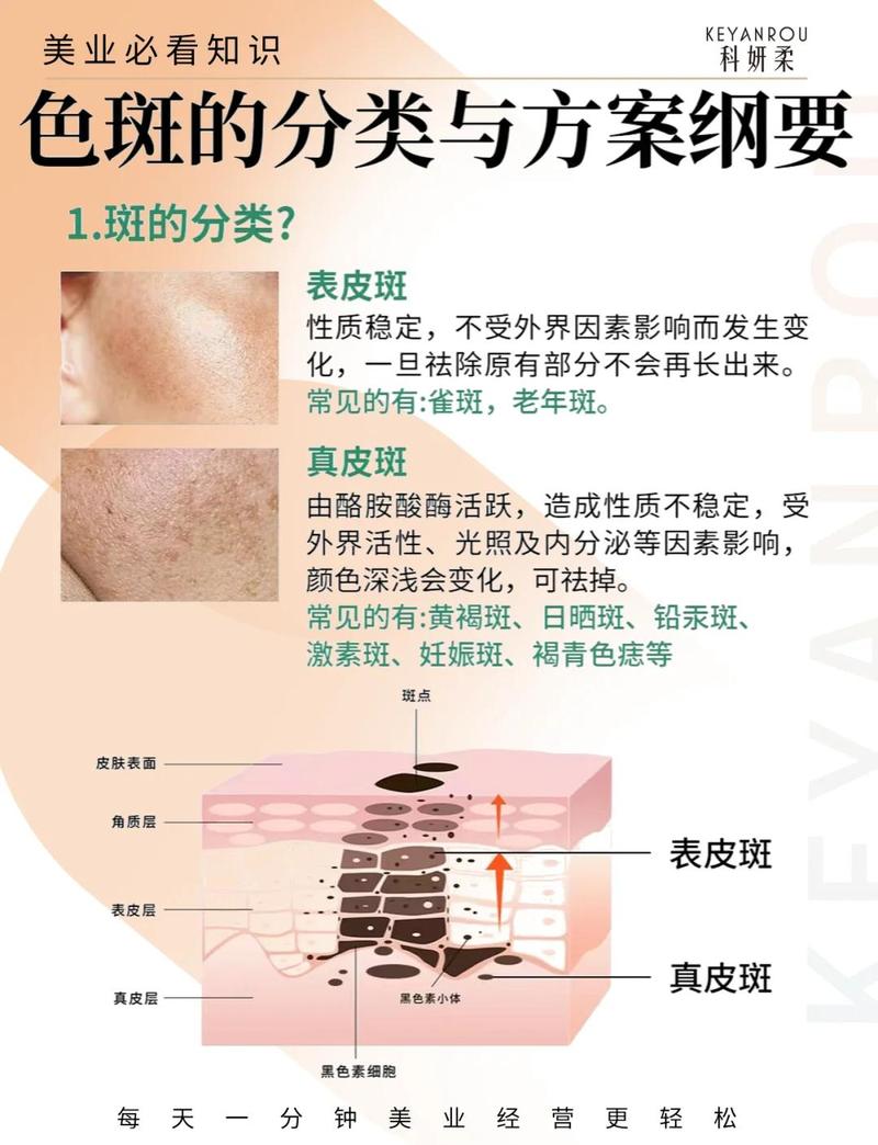 皮肤色斑形成的原因图标