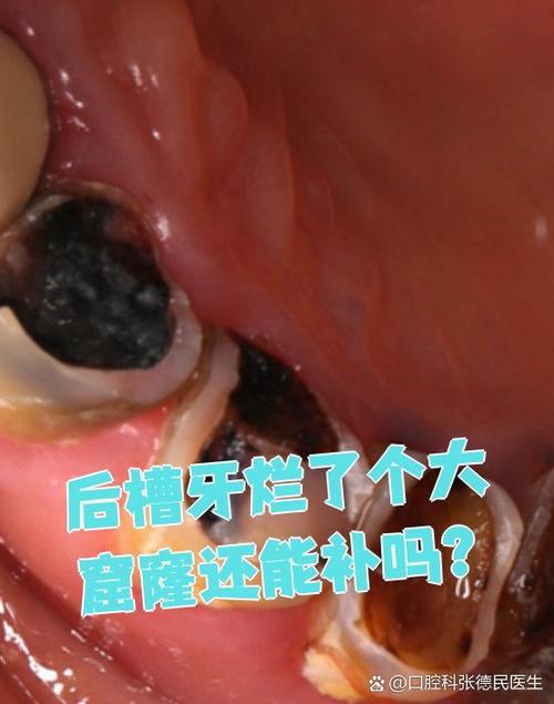牙齿烂了个窟窿图标