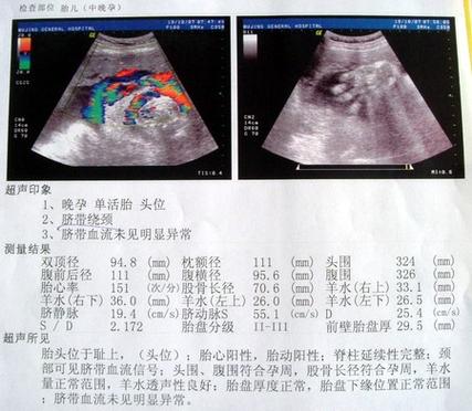 分析b超报告单的软件截图