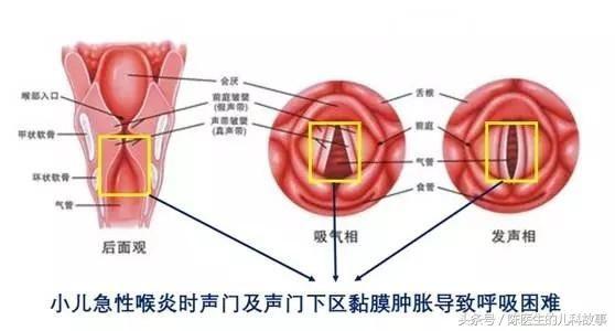 声音嘶哑是什么病的前兆图标