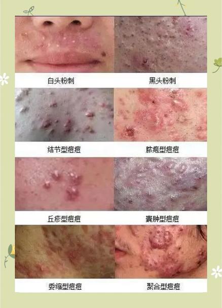 豆豆有哪几种类型图标
