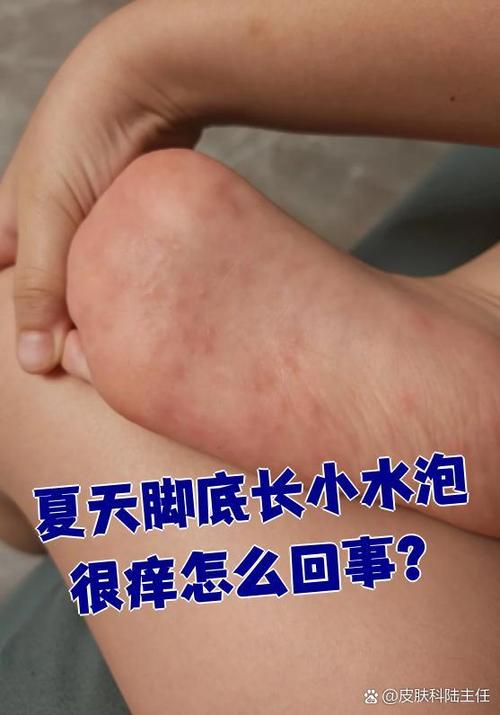 脚底很痒图标