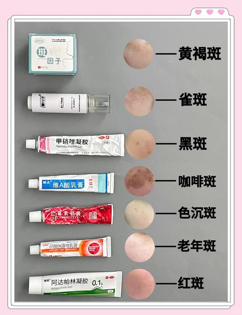 治黄褐斑最有效的方法图标