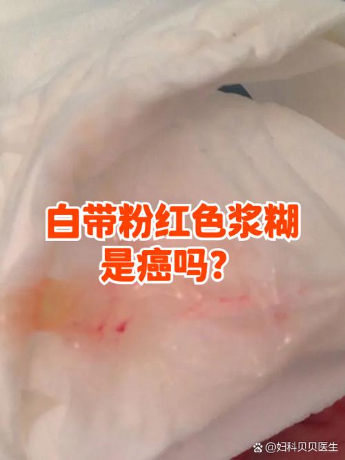 白带多带粉色