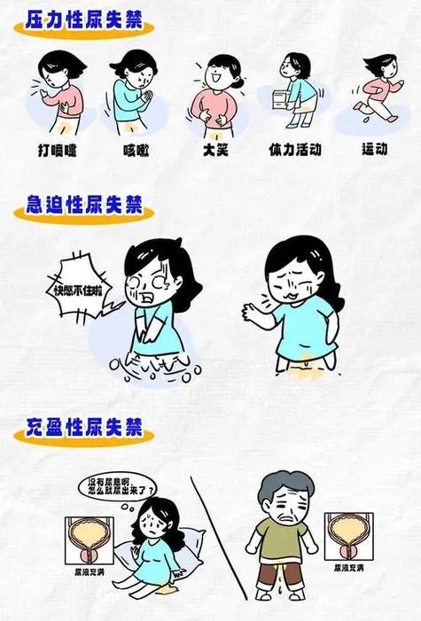 0到失禁要满足什么条件