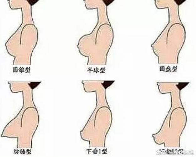 乳房形状几种图片大全图标