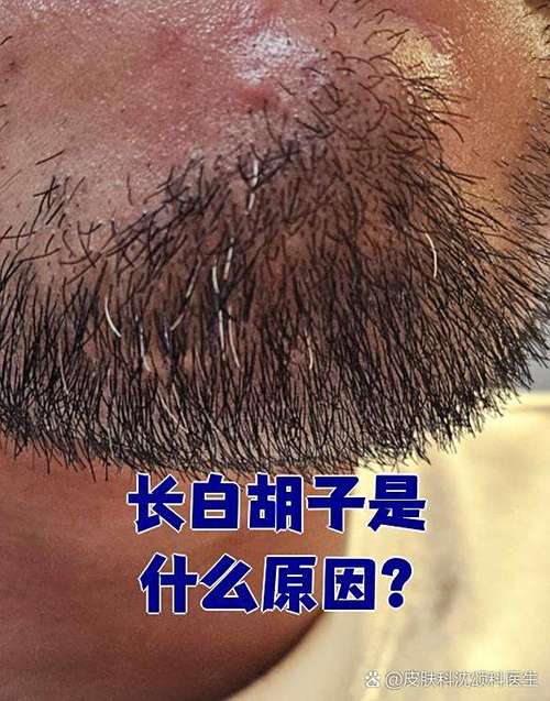 长了白胡子是什么征兆图标