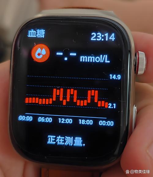 测血糖手表真的有用吗截图