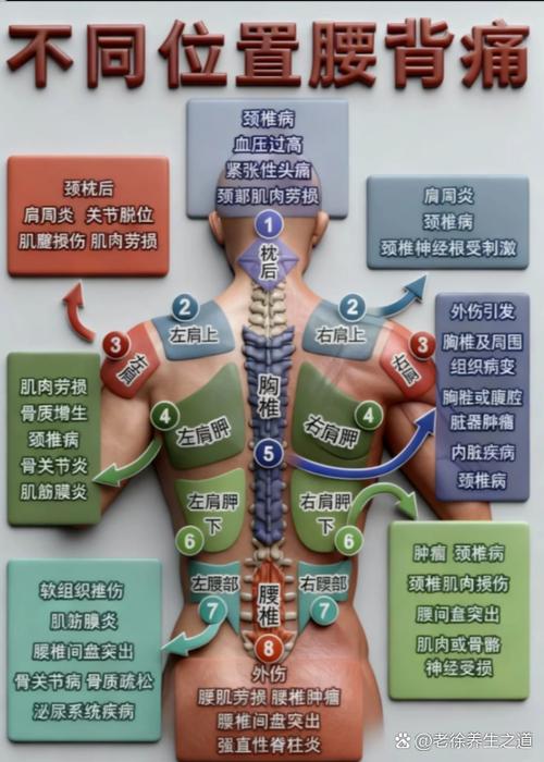 后背疼痛部位对照表图标