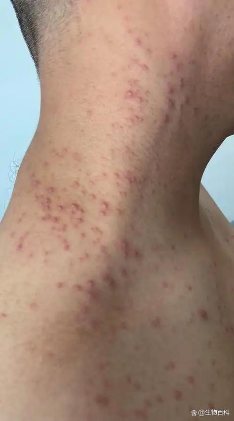 小猫身上有病菌吗会传染吗图标