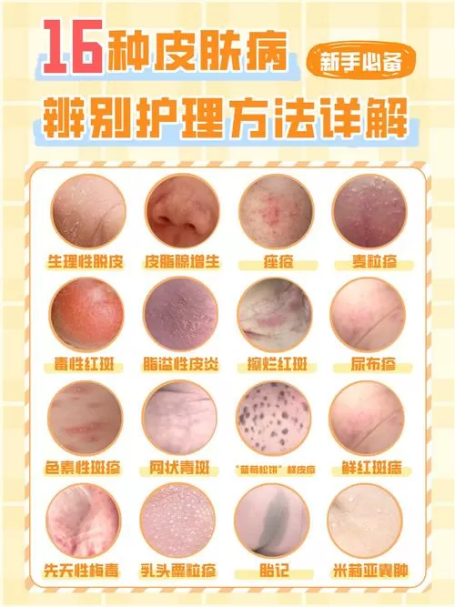 百度扫一扫识别皮肤病怎么用