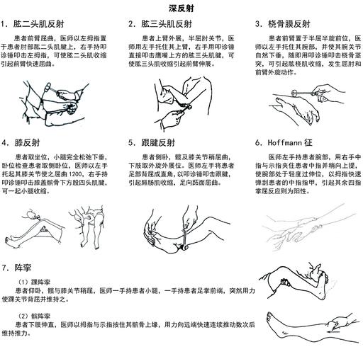 深反射和浅反射的区别图标