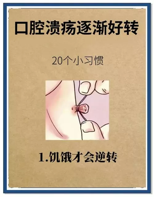 口腔溃疡怎么治截图