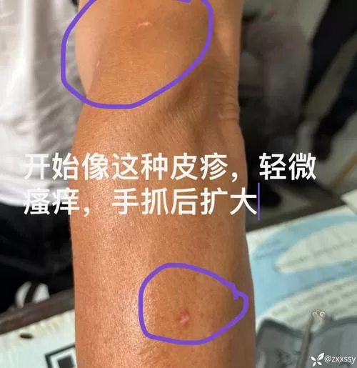 百度扫一扫识别皮肤病在哪里识别图标