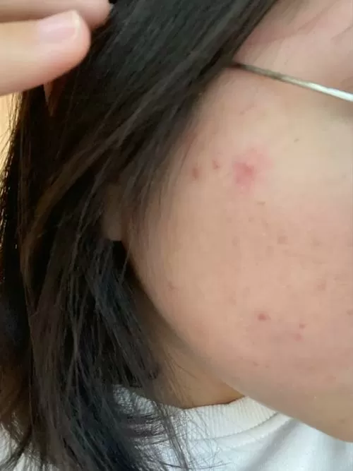 脸上起了好多红包怎么办图标
