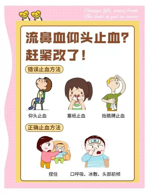 流鼻血最好的处理方法图标