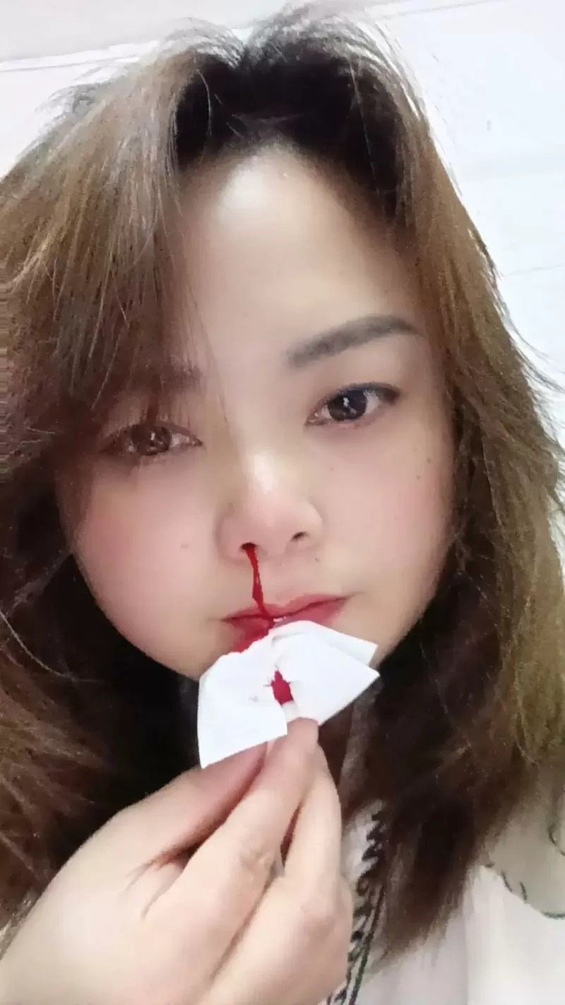 看见美女流鼻血视频截图