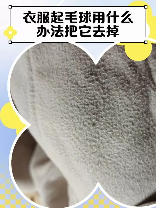 怎样去除衣服上的毛球截图