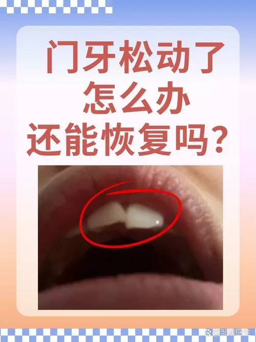 门牙碰松动了怎么办还能恢复吗截图