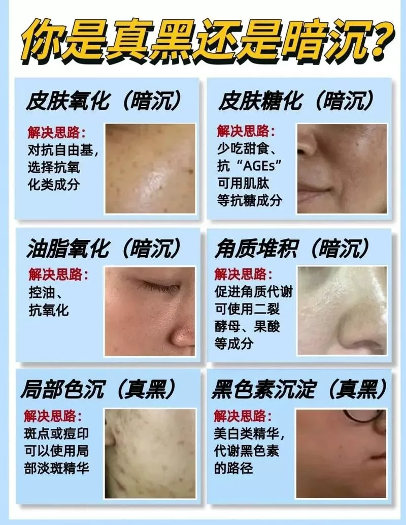 脸黑色素沉着怎么去除图标