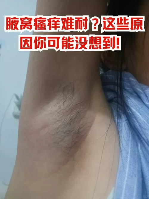 挠腋窝能忍多久截图
