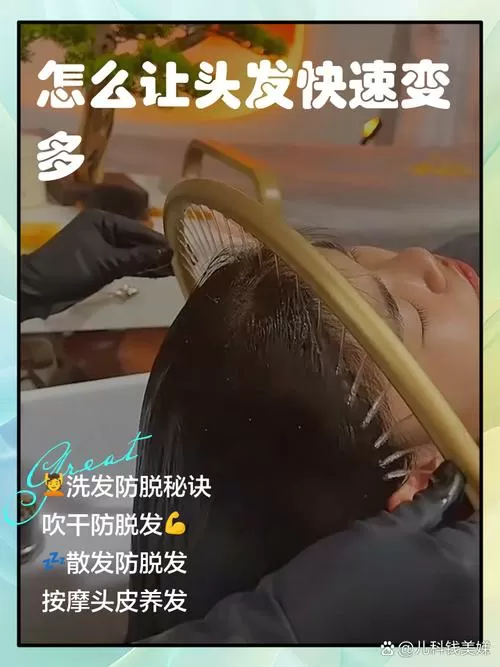 怎么让头发变多