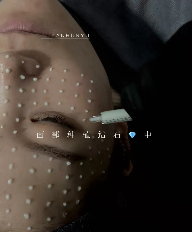 脸上种钻石大概多少钱图标