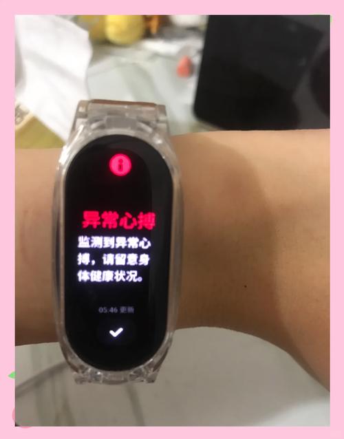 红米手环屏幕没反应图标