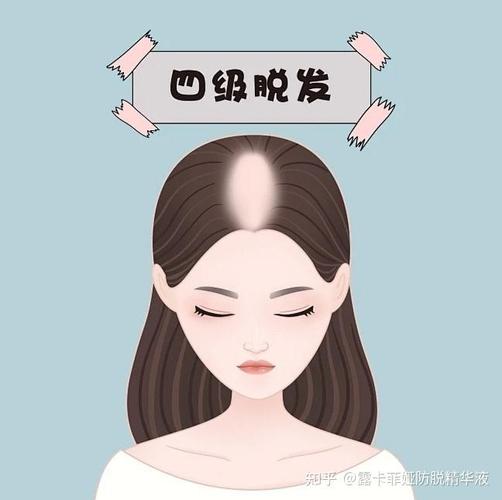 发旋掉头发能长回来么