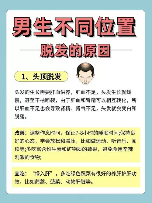 男生掉头发多是什么原因图标