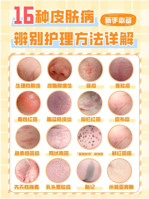 百度扫一扫识别皮肤病免费版手机正版
