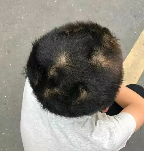 男孩有两个头旋截图