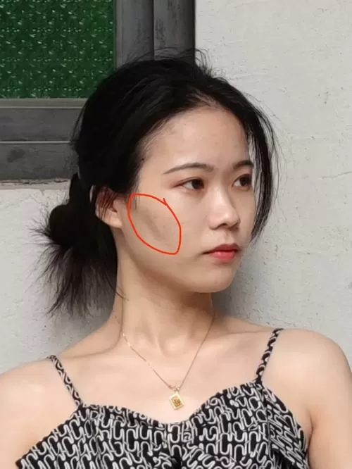 脸颊有凹陷图标