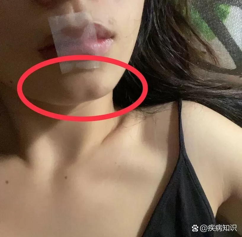 下巴有个凹陷图片