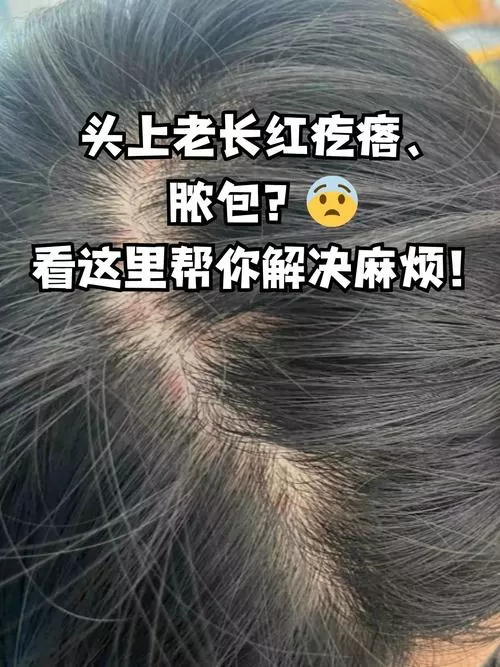 头皮红疙瘩图标