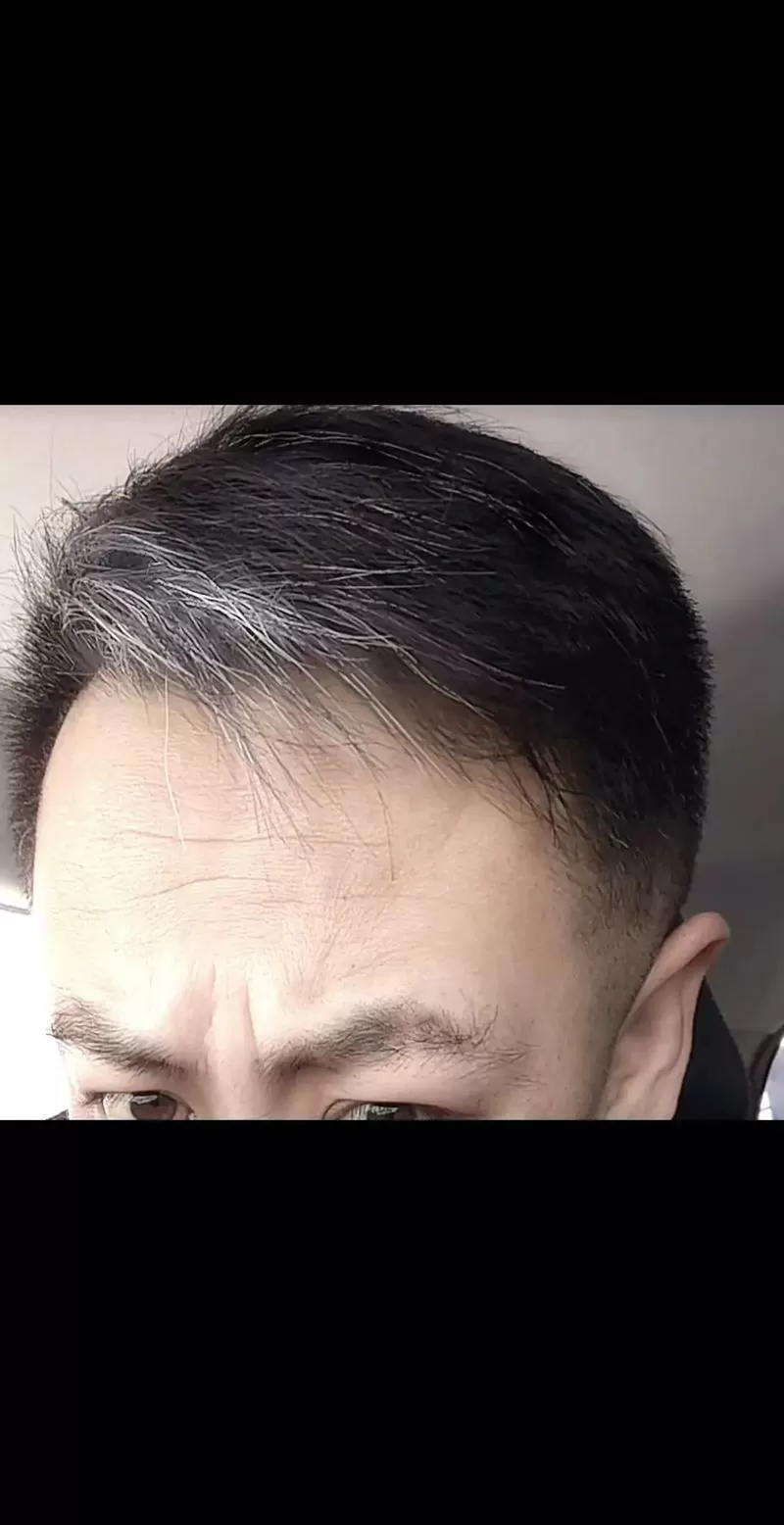 前额一撮白发在相学里截图