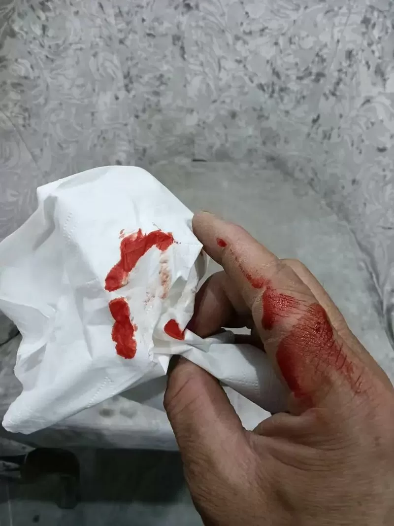 带血的纸巾流鼻血图片图标