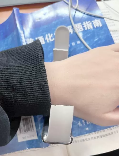 小米手表经常断开连接图标