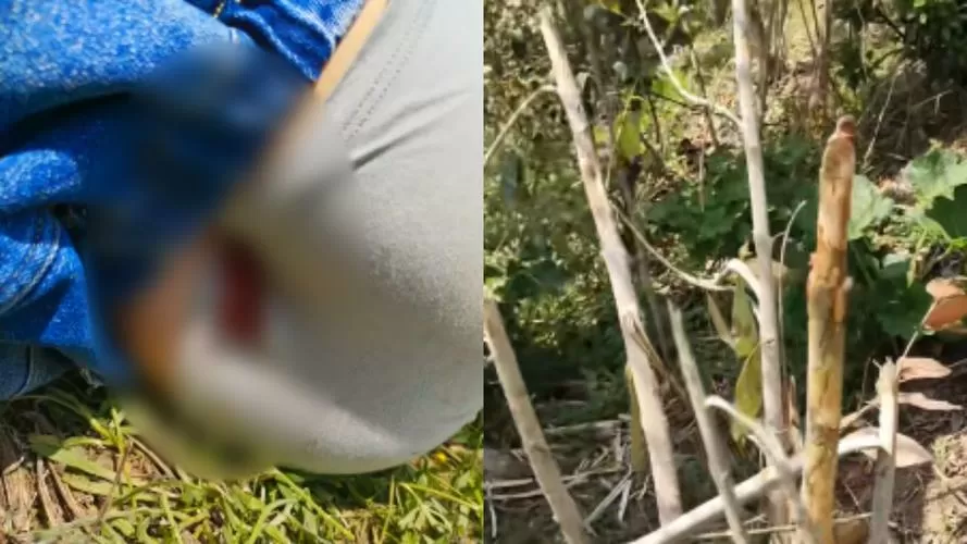 男孩生殖器被半米长树枝贯穿截图